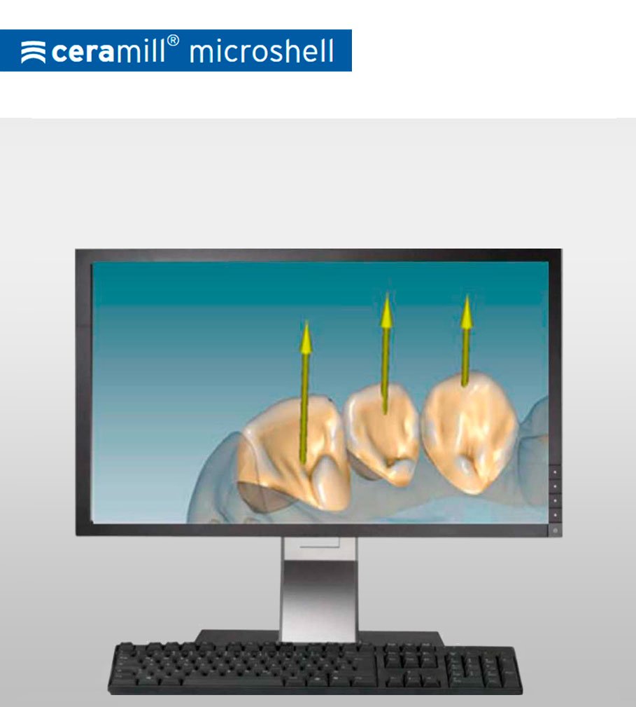 Design CAD | Integra Dental Tech